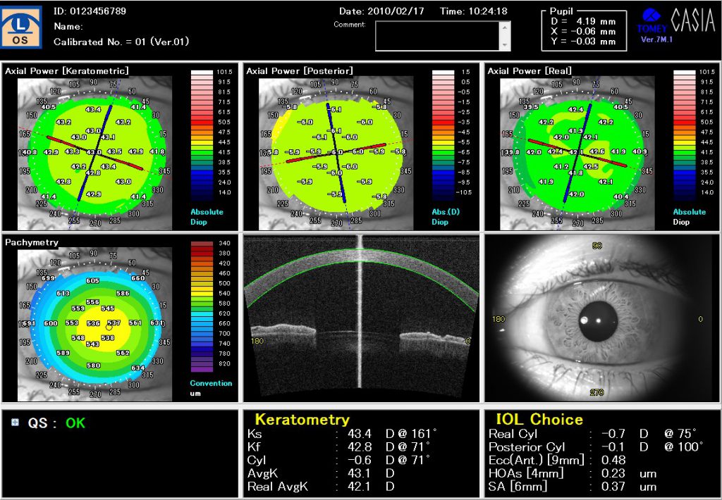 MAP(IOL Screening) | 大船・鎌倉の眼科 - 福田眼科